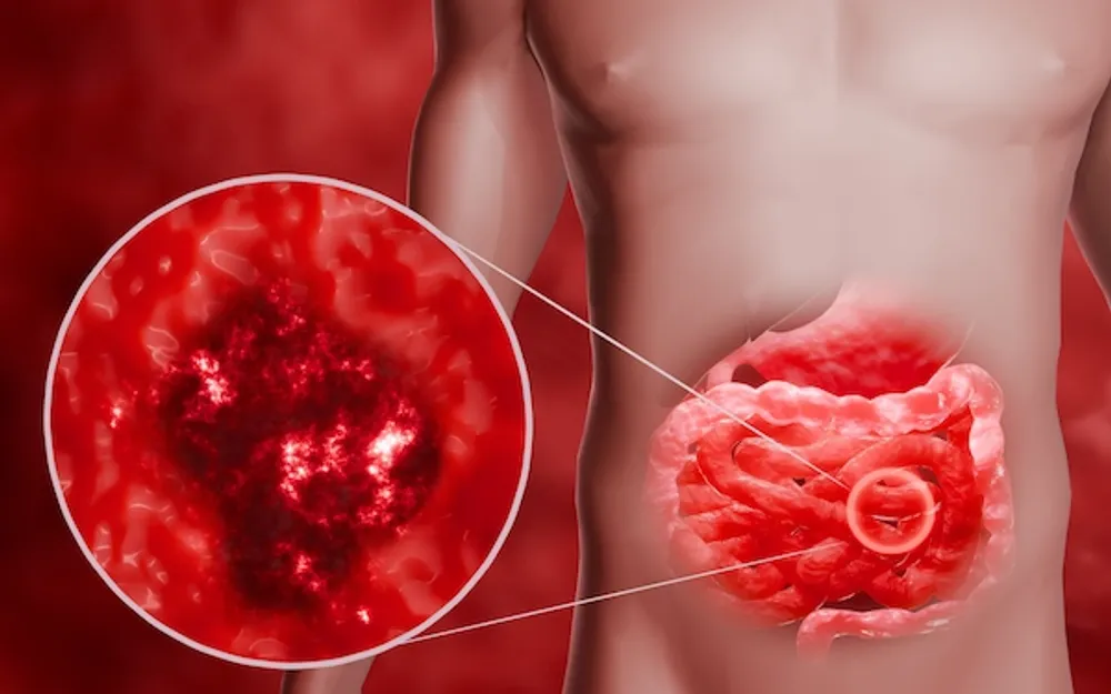 gastroenteritis virus spread