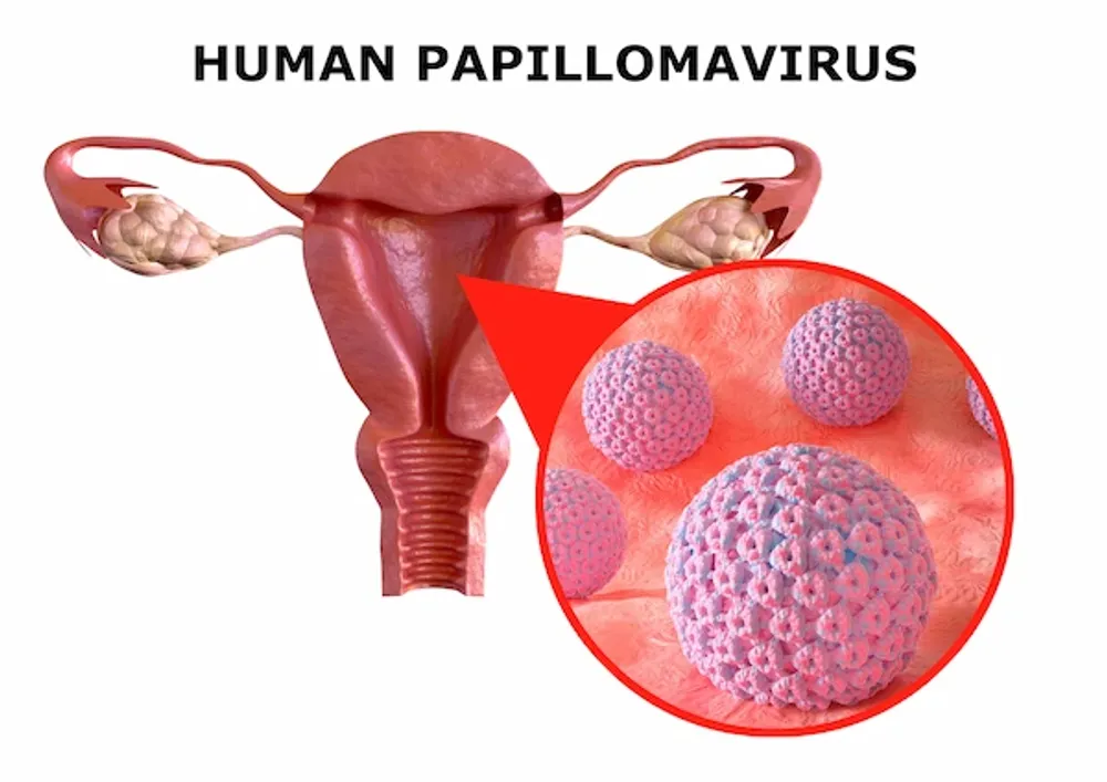 hpv virus itching