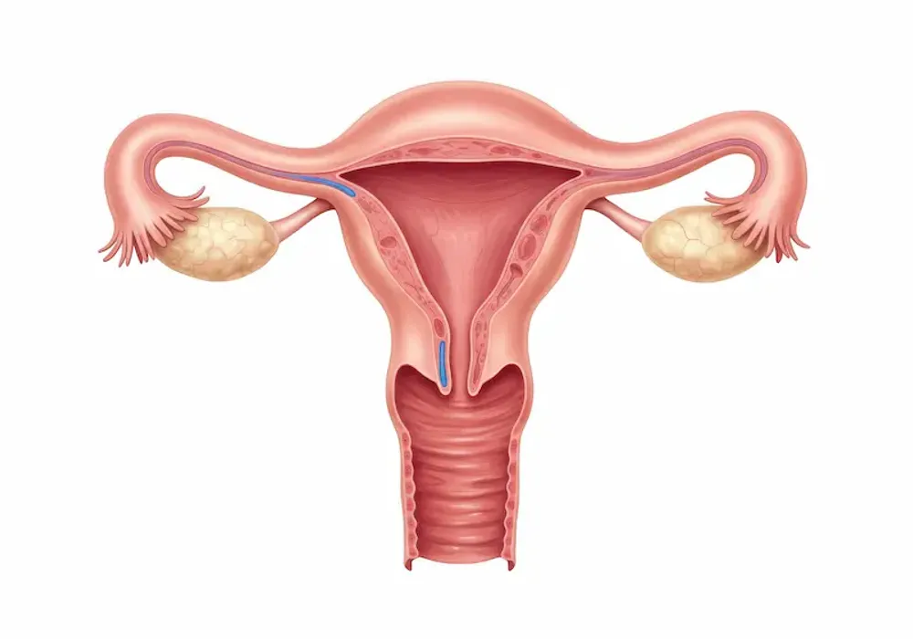 polyps in uterus