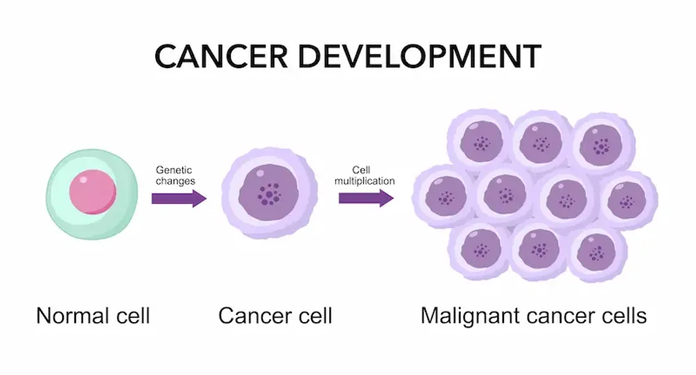 cancer development