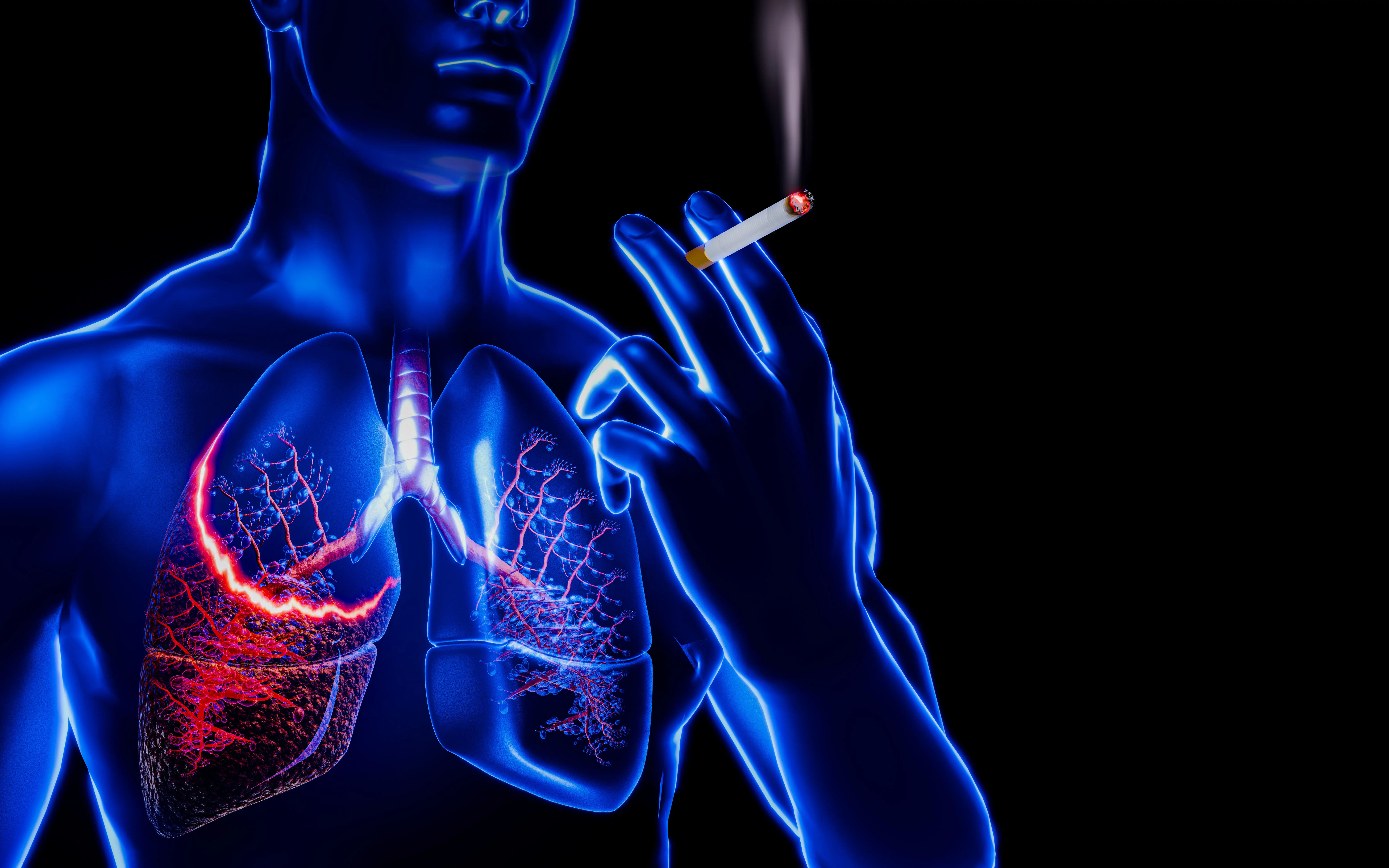 Understanding Lung Fibrosis: Symptoms, Causes, and Hope