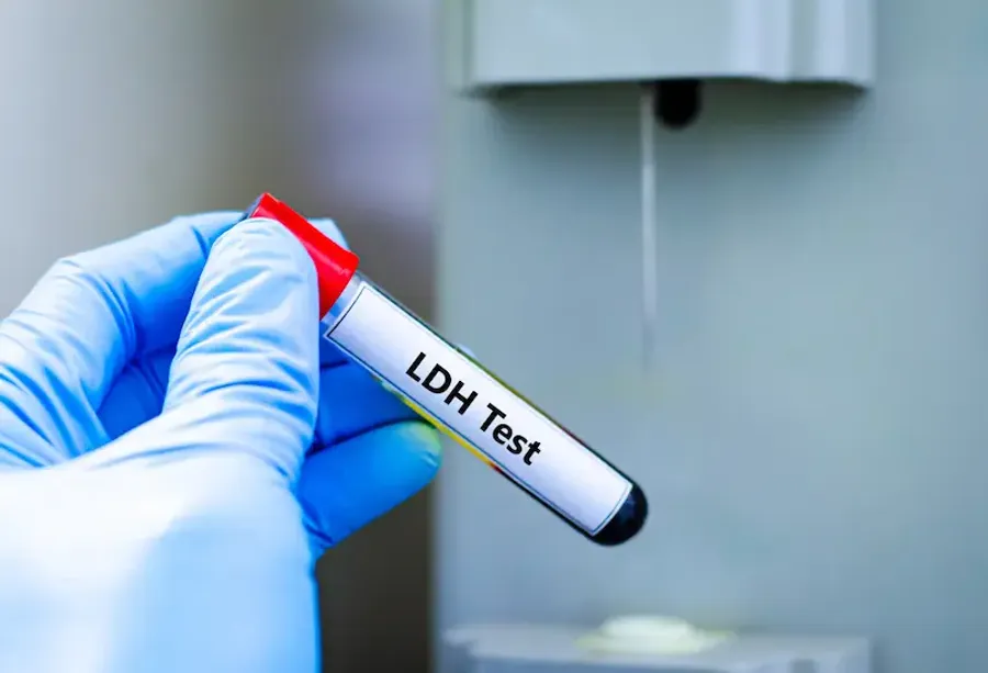 How To Reduce Ldh Level?