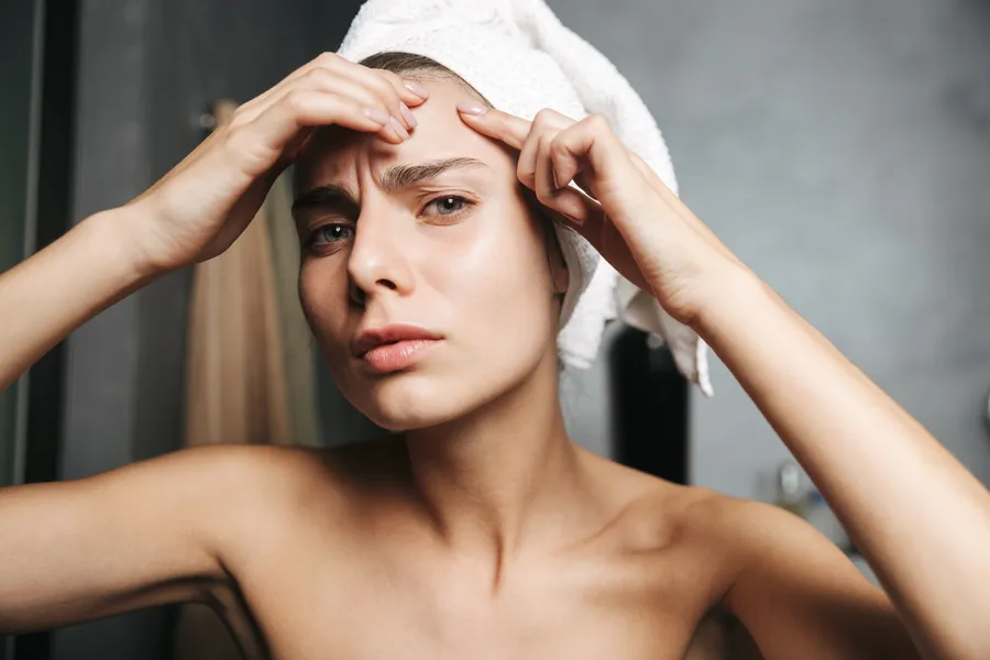How To Reduce Pimples On Forehead?