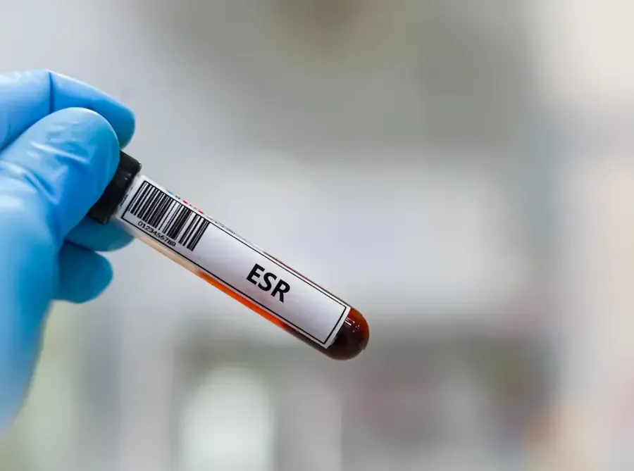 How to Reduce ESR in Blood?
