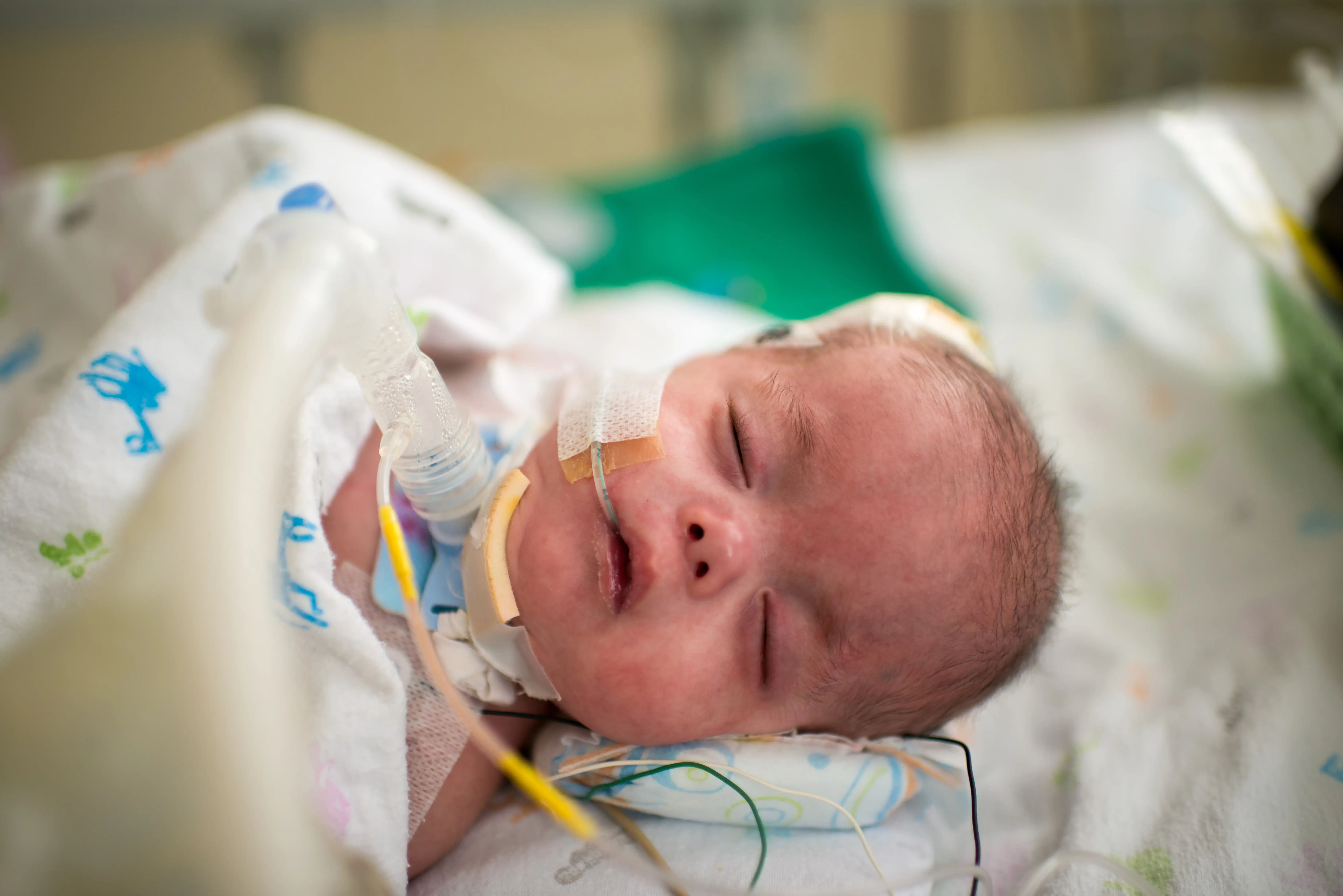 XXY Syndrome Guide: Understanding Klinefelter Syndrome