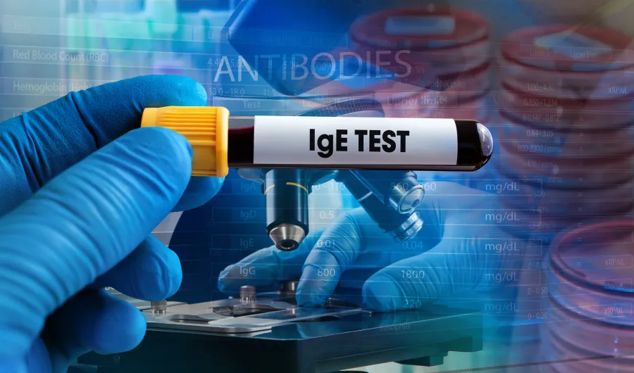 How To Reduce IgE Levels?