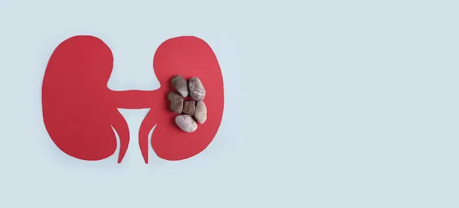 Gallbladder Vs. Kidney Stones