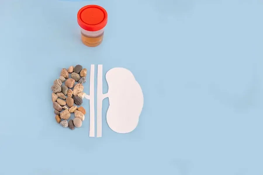 During Kidney Transplant Is Old Kidney Removed