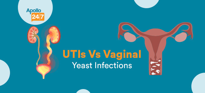 UTIs Vs Vaginal Yeast Infection: What's The Difference and How to ...