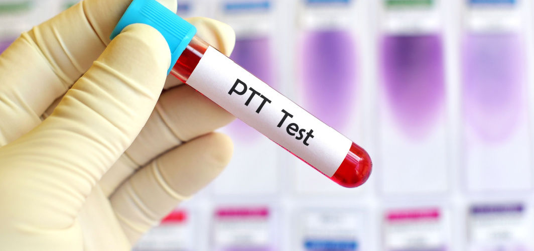 What Is The Purpose Of The PTT Test 