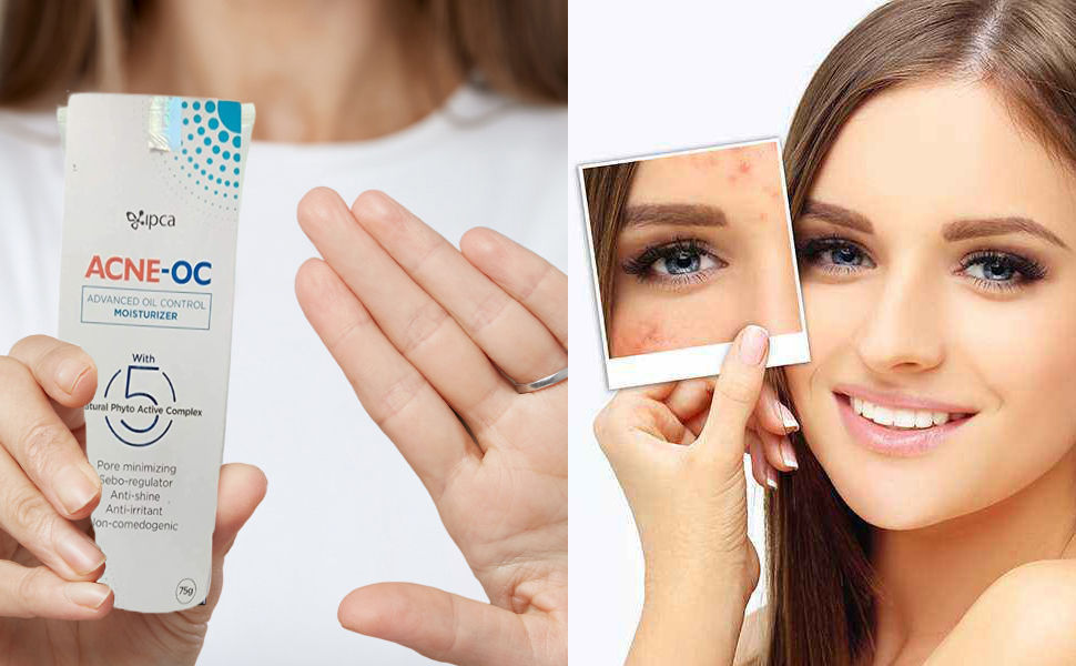 Buy Acne-OC Moisturizer Cream 75 gm | 19 Minutes Delivery | Apollo Pharmacy