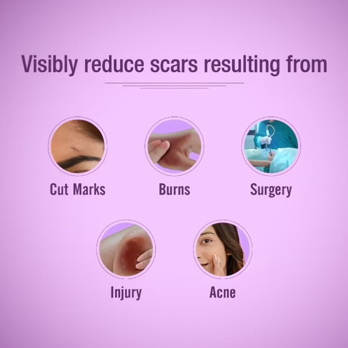 Buy Mederma Advanced Plus Scar Gel 10 gm | 19 Minutes Delivery | Apollo ...