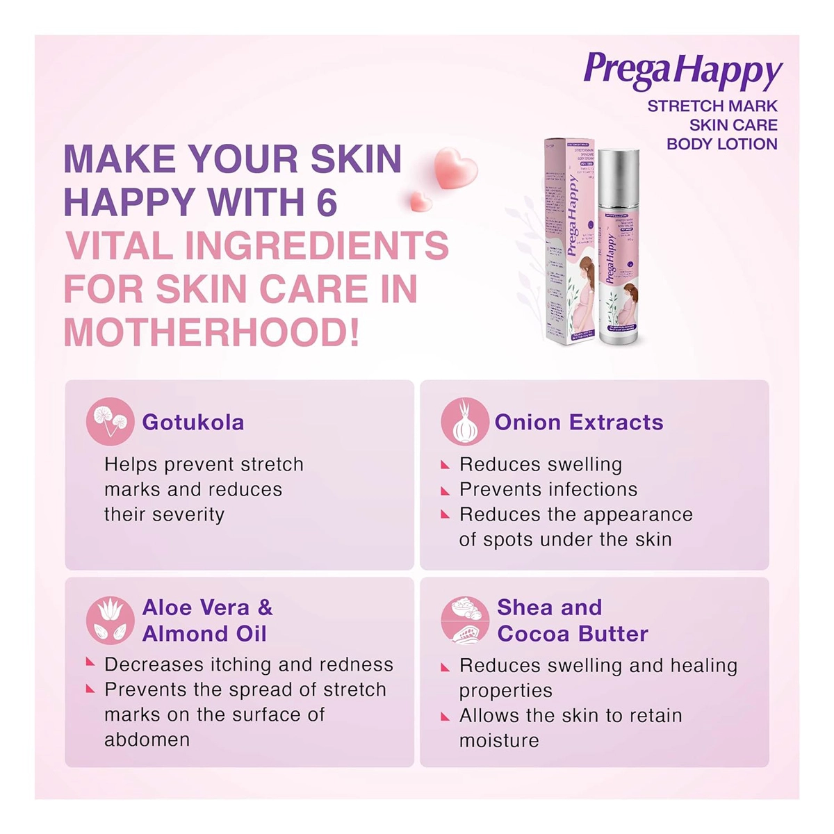 Prega Happy Stretch Mark Skin Care Body Cream 100 gm | Soothes Itching ...