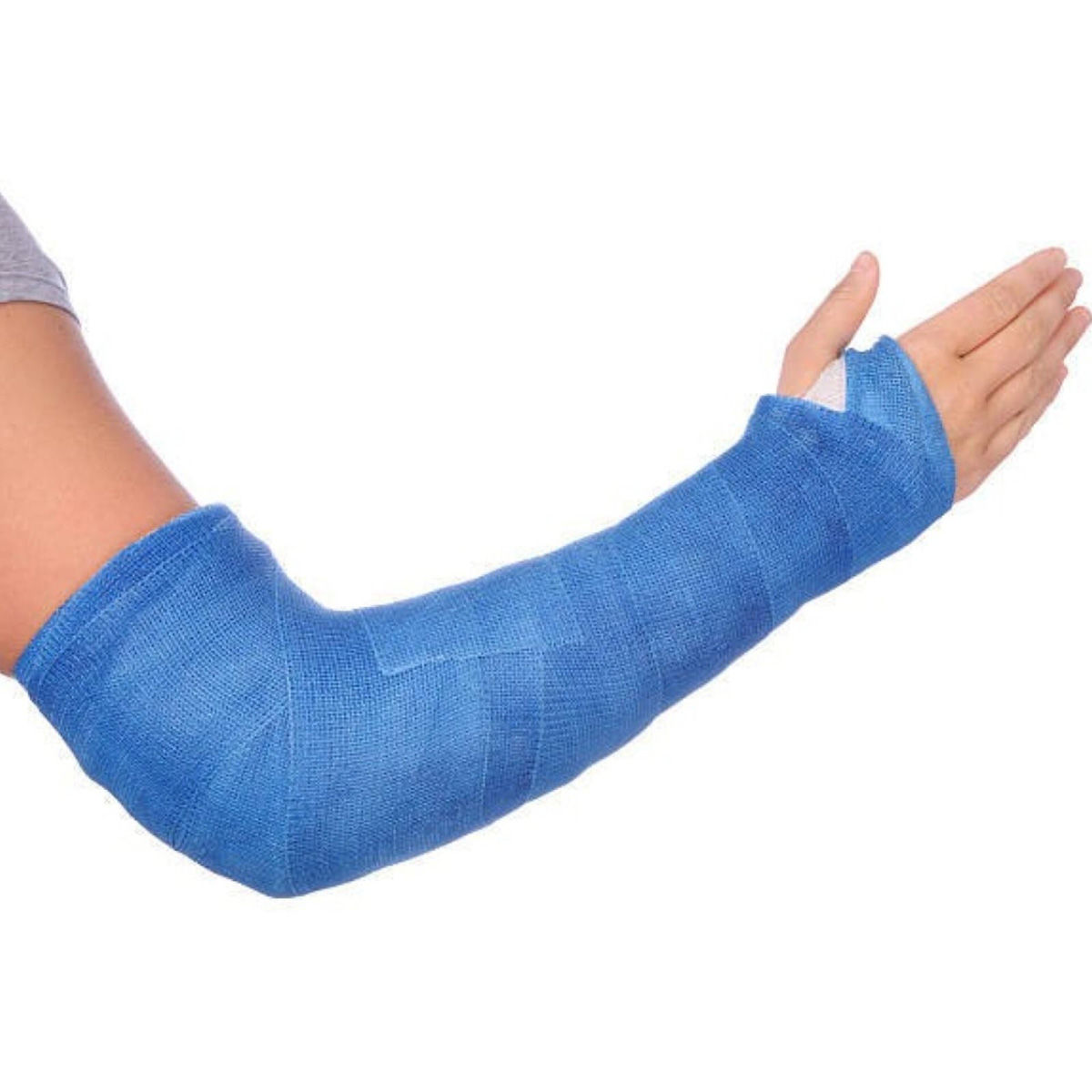 Prime Cast 7.5cm X 3.6cm Price, Uses, Side Effects, Composition ...