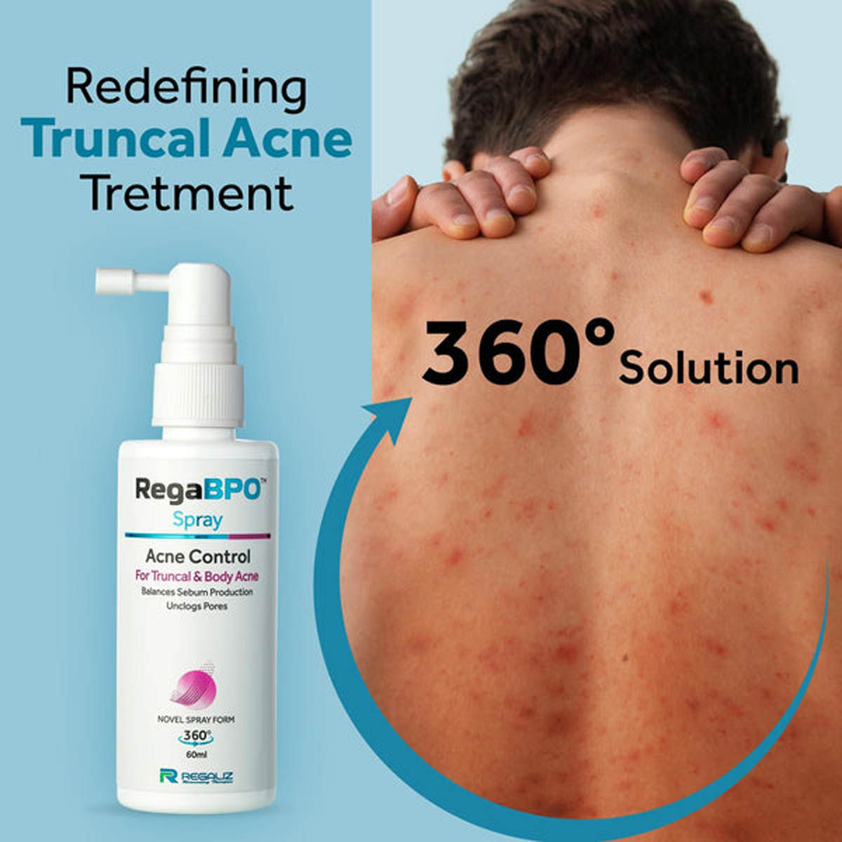Regabpo Spray 60 ml | Uses, Side Effects, Price | Apollo Pharmacy