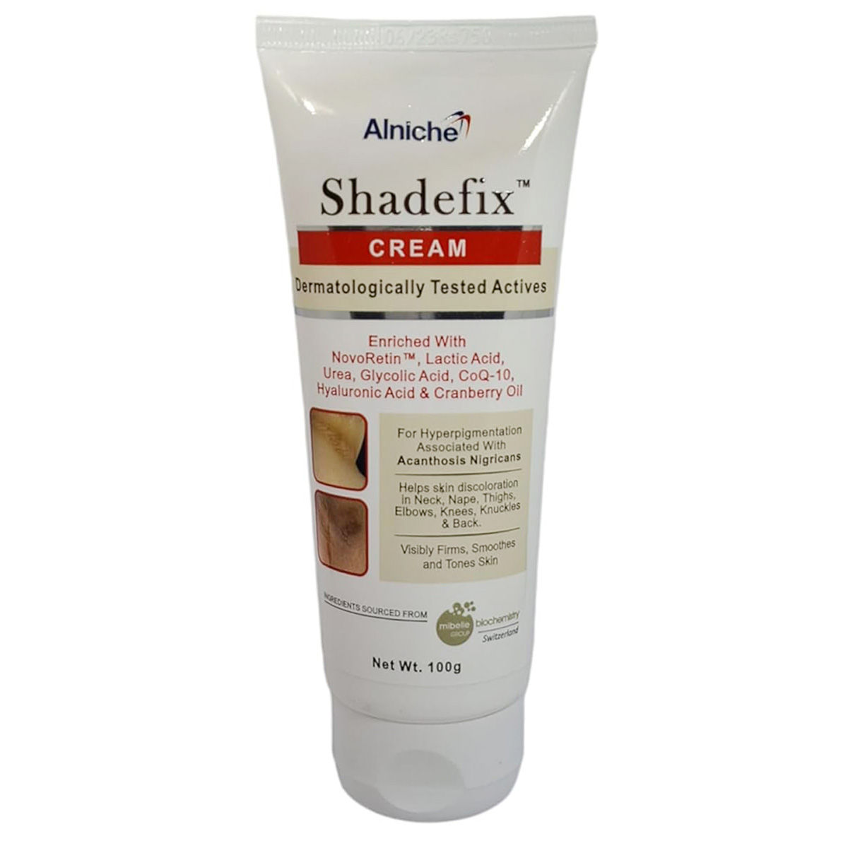 Shadefix Cream | Uses, Side Effects, Price | Apollo Pharmacy