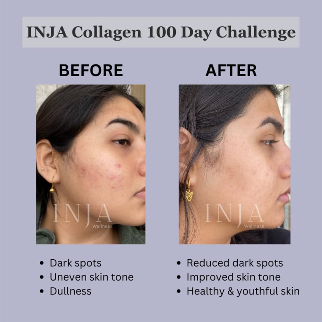 INJA Fit Collagen Chocolate Flavour Powder, 250 gm Price, Uses, Side ...