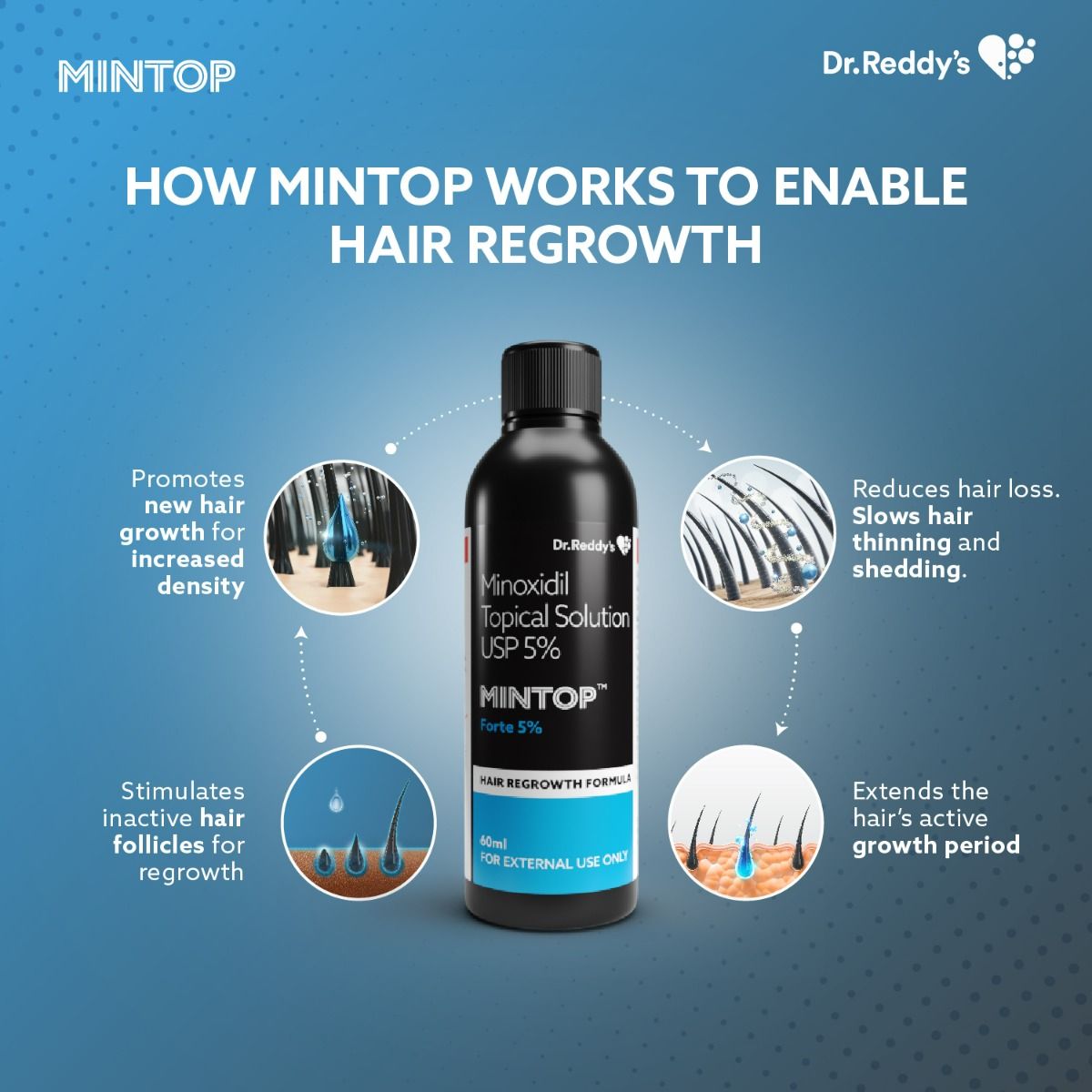 Mintop Forte 5% Solution | Uses, Side Effects, Price | Apollo Pharmacy