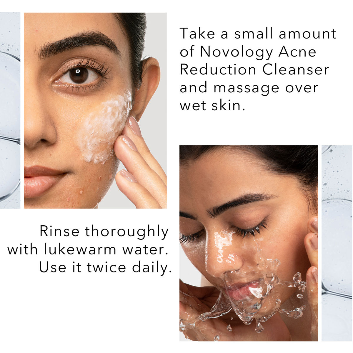 Novology Acne Reduction Cleanser, 150 gm Price, Uses, Side Effects ...