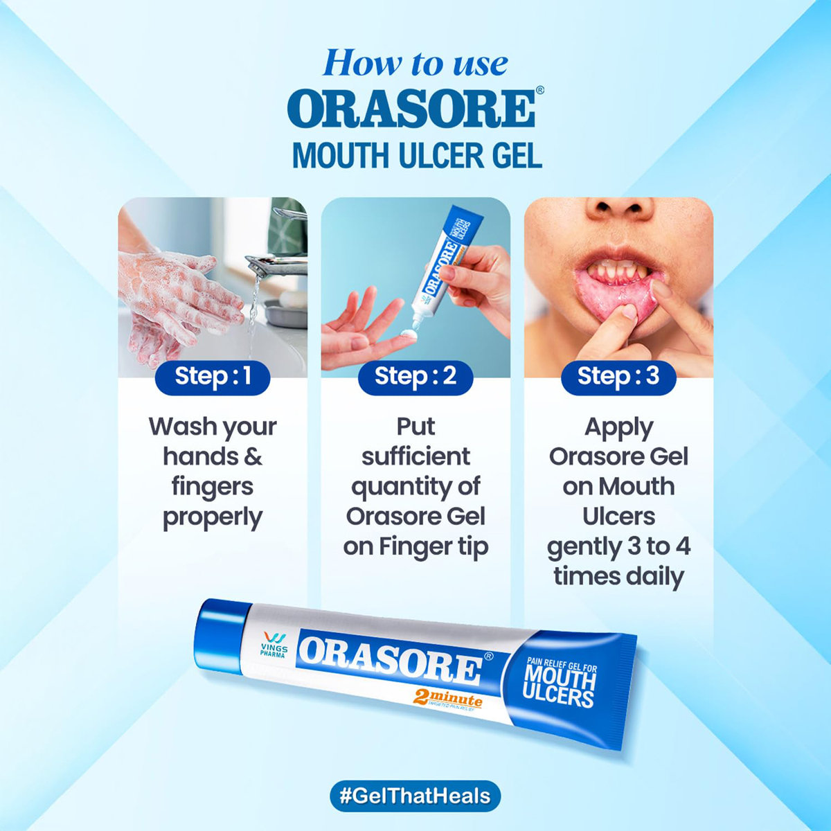 Buy Orasore Mouth Ulcer Relief Gel | 19 Minutes Delivery | Apollo Pharmacy