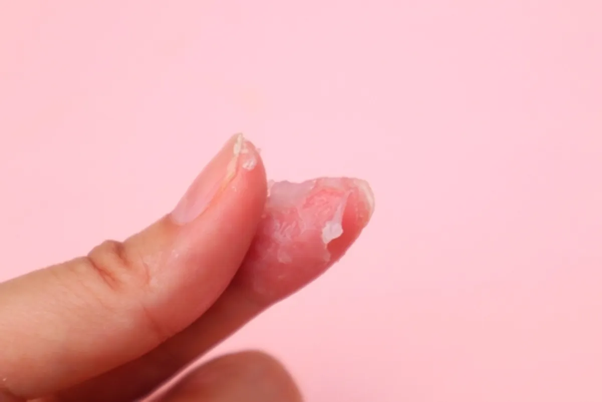 slime texture discharge